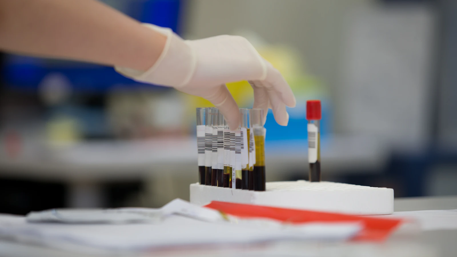 Bloedtest zonder verwijzing: de complete gids | Vitalcheck